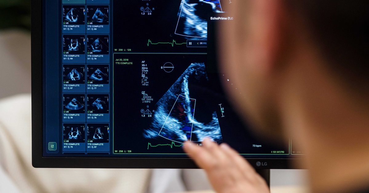 Dr Robert Avram : l'IA au service de la cardiologie | Fondation de…